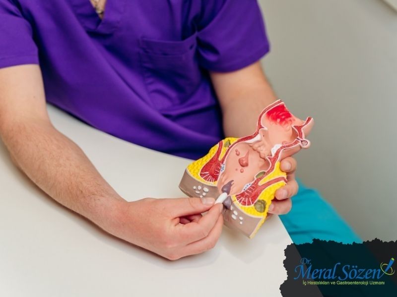 Dr. Meral Sözen | Ankara Gastroenteroloji ve İç Hastalıkları Uzmanı